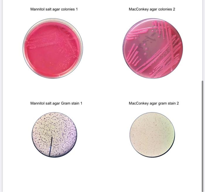 Solved Mannitol salt agar colonies 1 MacConkey agar colonies | Chegg.com