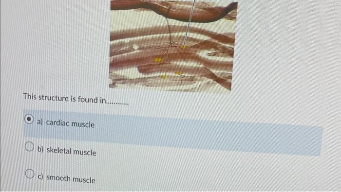 Solved Identify the epithelium. a) simple cuboidal b) simple | Chegg.com