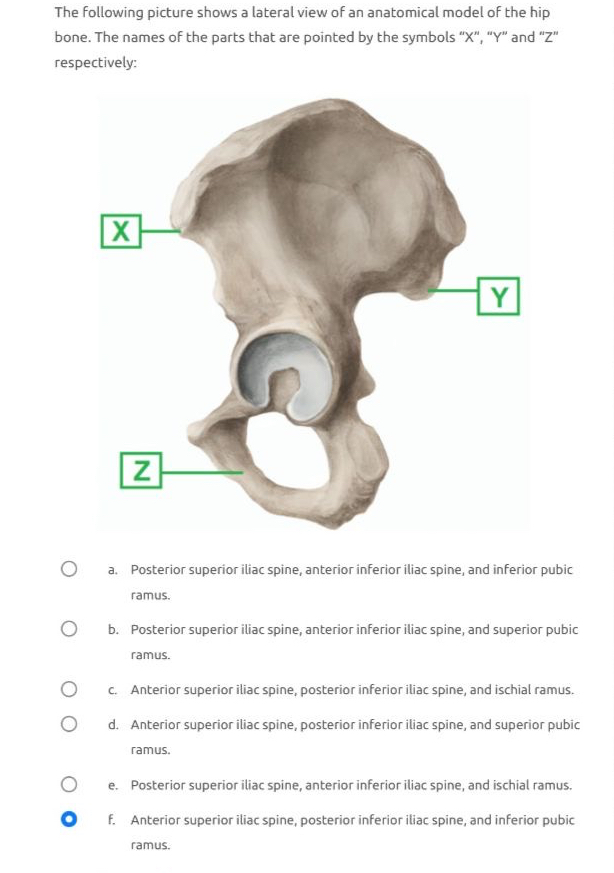 Solved The following picture shows a lateral view of an | Chegg.com