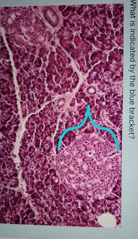 Solved What is indicated by the blue bracket? 500 pm | Chegg.com