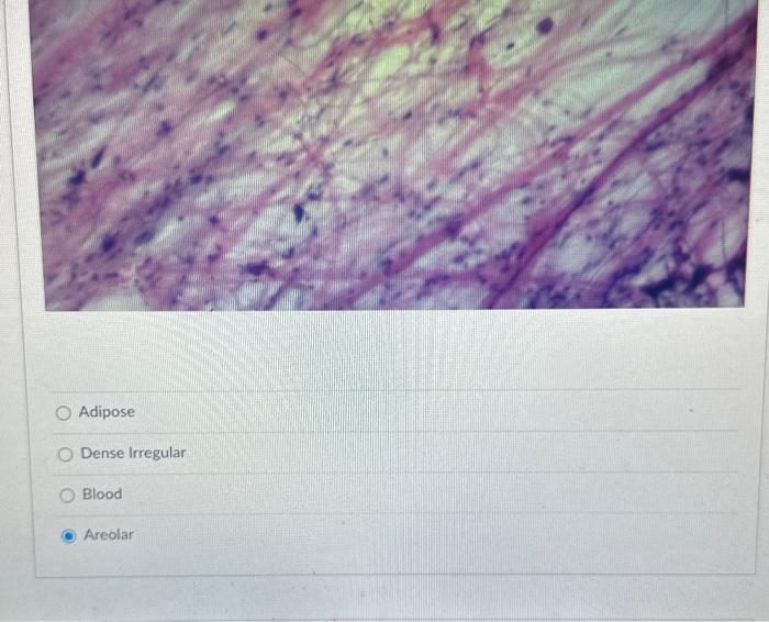 Solved Identify this tissue Adipose Dense Irregular Blood | Chegg.com