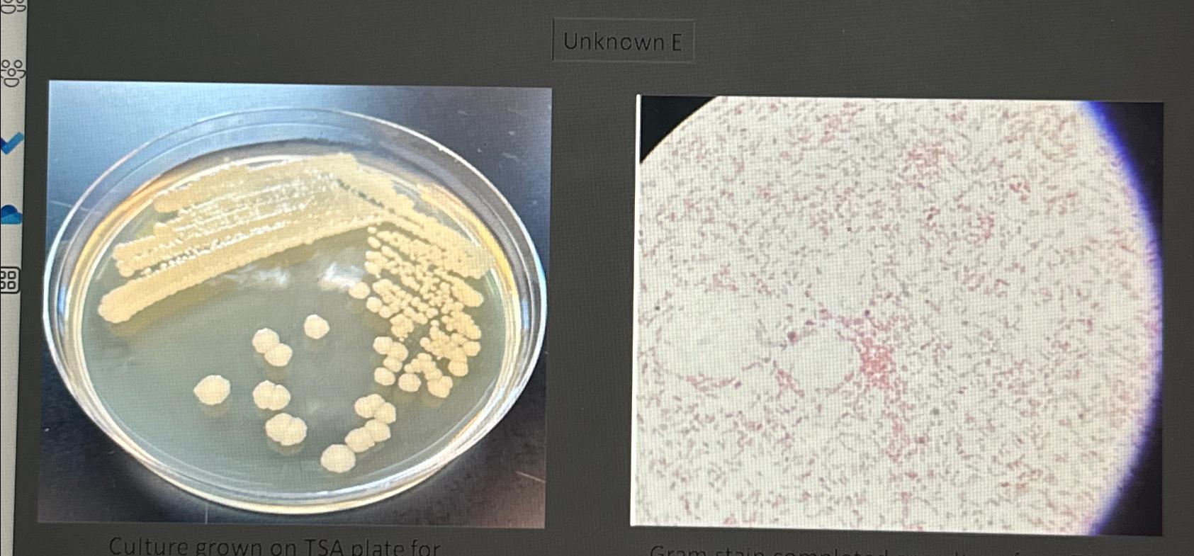 Solved Which Gram stain is this? ﻿Gram-positive cocci | Chegg.com