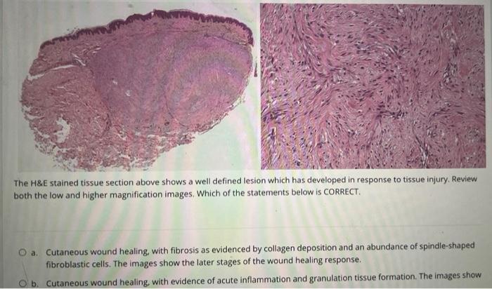 Solved The H\&E stained tissue section above shows a well | Chegg.com