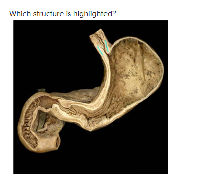 Solved Which structure is highlighted IN BLUE? A. ﻿pyloric | Chegg.com