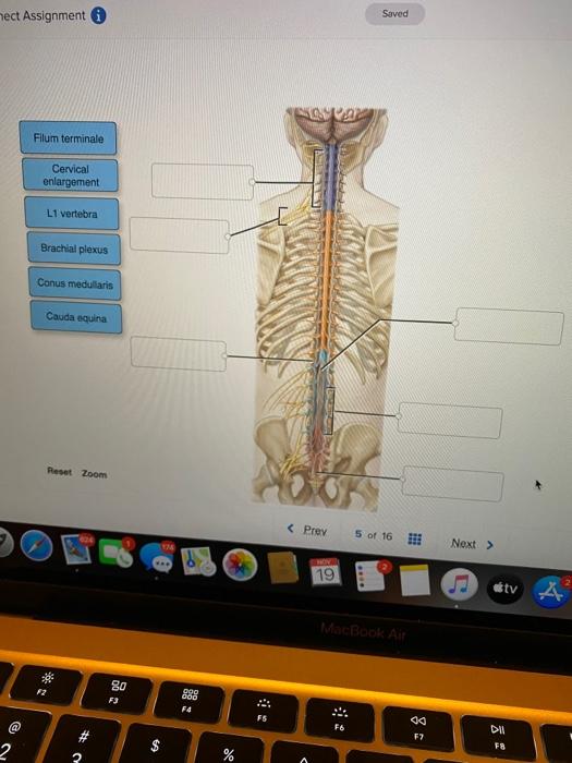 Solved nect Assignment Saved Filum terminale Cervical | Chegg.com Solved nect Assignment Saved Filum terminale Cervical | Chegg.com