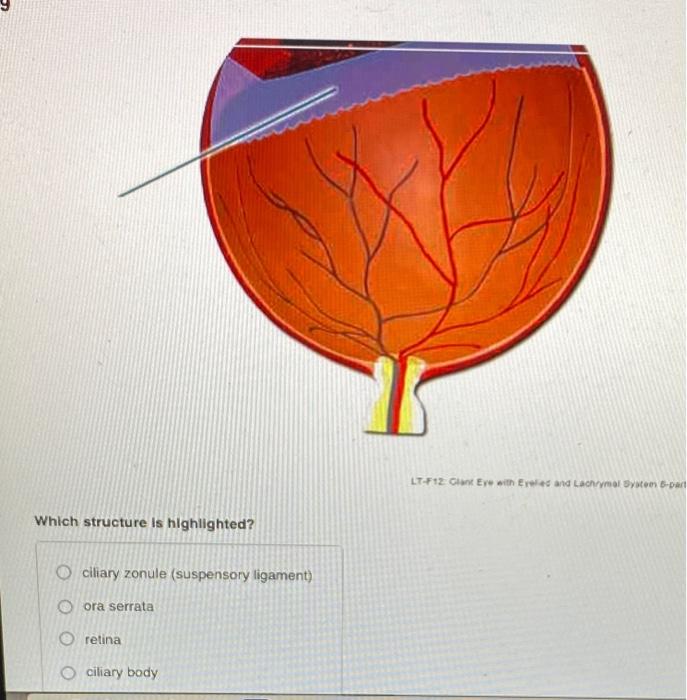 Solved LT-F12. Clint Eye with Ereled and Lachymal System | Chegg.com