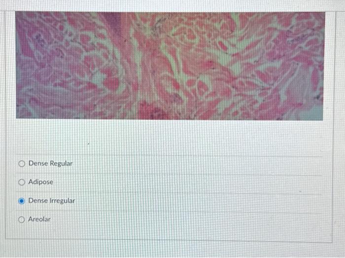 Solved Identify this tissue: Dense Regular Adipose Dense | Chegg.com