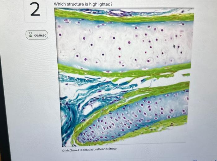 Multiple Choice lamella with osteocytes lacuna with | Chegg.com