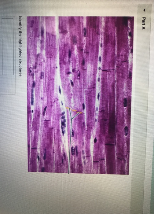Solved Part A Identify The Highlighted Structure Part A 8780
