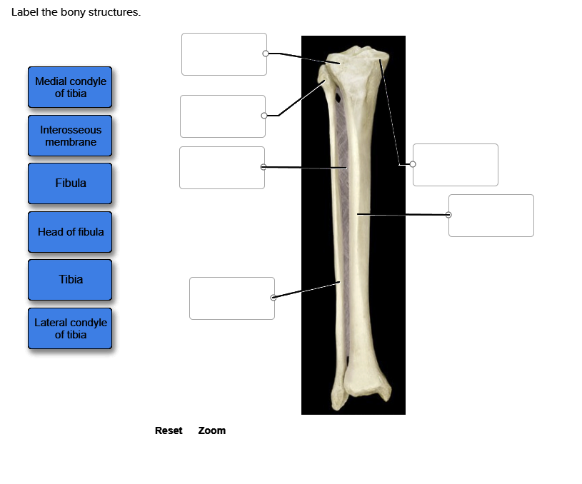 Solved Label the bony structures. | Chegg.com