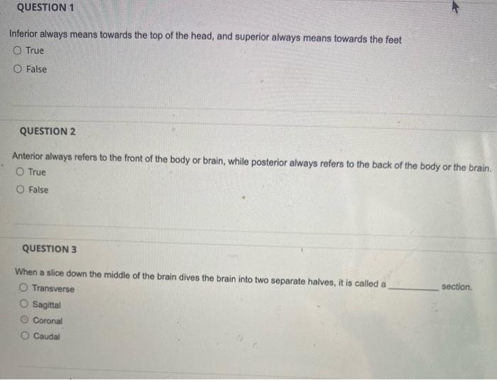 Solved Inferior always means towards the top of the head, | Chegg.com
