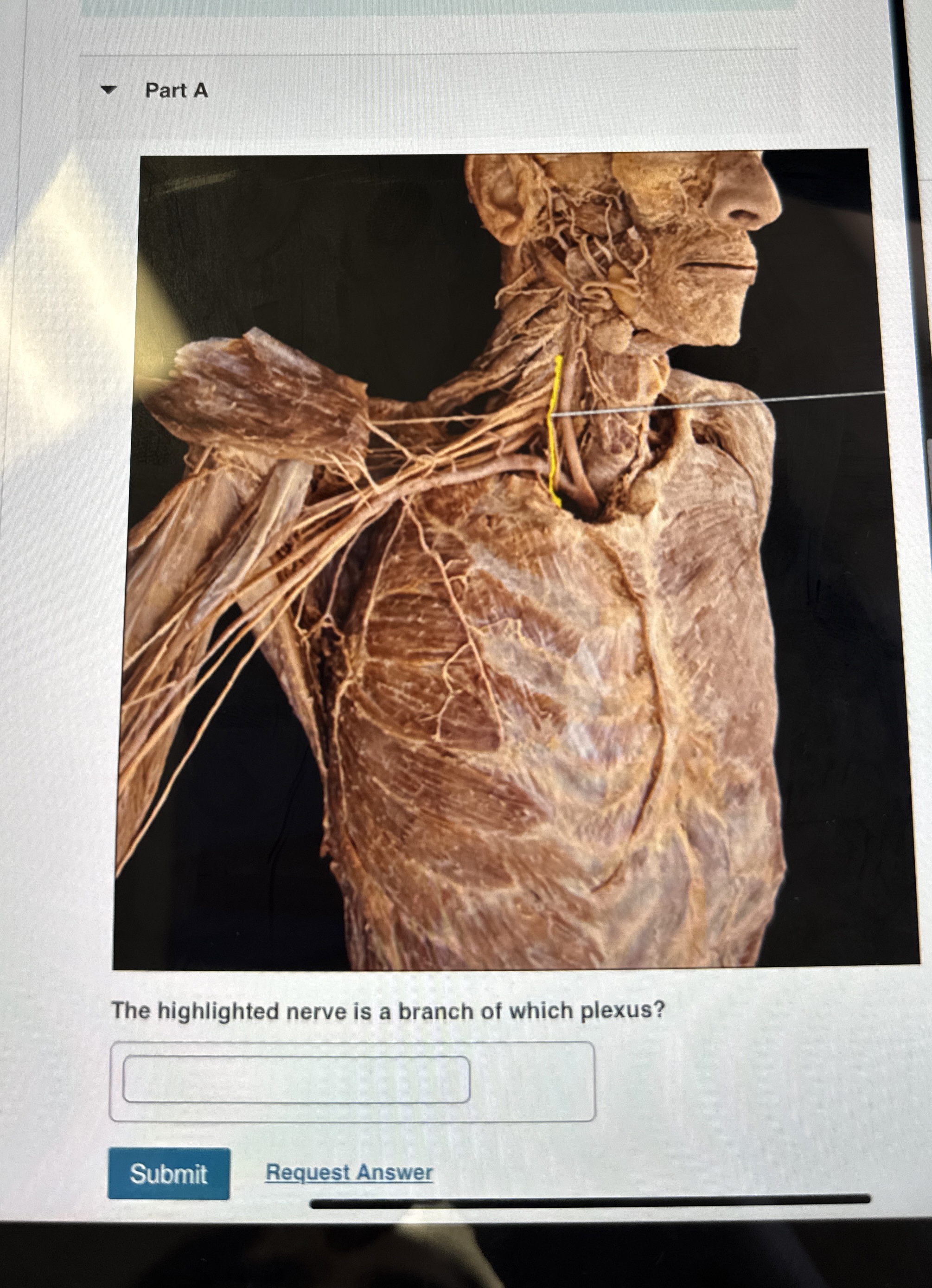 Solved Part AThe highlighted nerve is a branch of which | Chegg.com