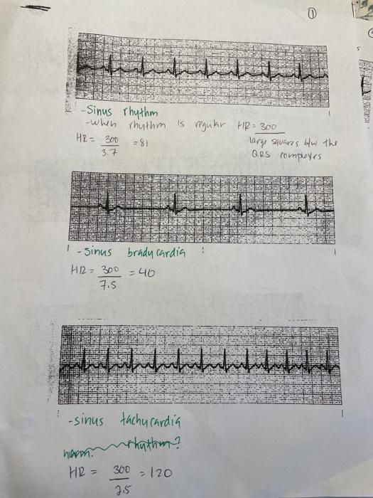 Solved Identify name of rhythm. Rate Regularity PR | Chegg.com