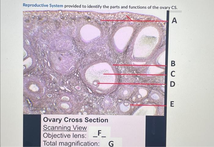 Solved Reproductive System provided to identify the parts | Chegg.com