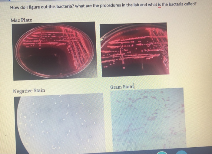 Solved How do I figure out this bacteria? what are the | Chegg.com
