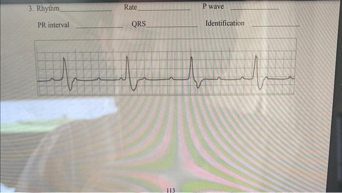Solved PR interval QRS Identification | Chegg.com