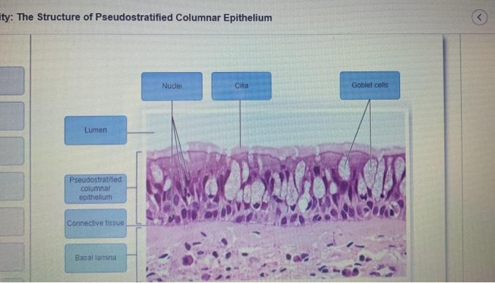 Solved ity: The Structure of Pseudostratified Columnar | Chegg.com