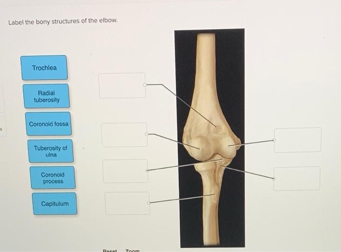 Solved Label the bony structures of the elbow. Trochlea | Chegg.com