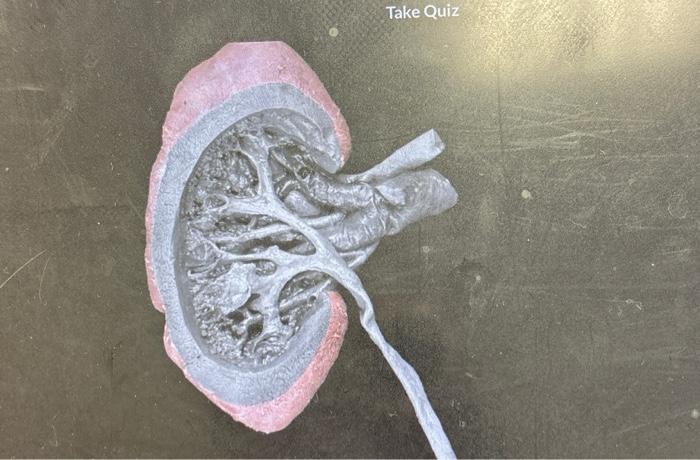 Solved Identify highlighted structure urinary bladder | Chegg.com