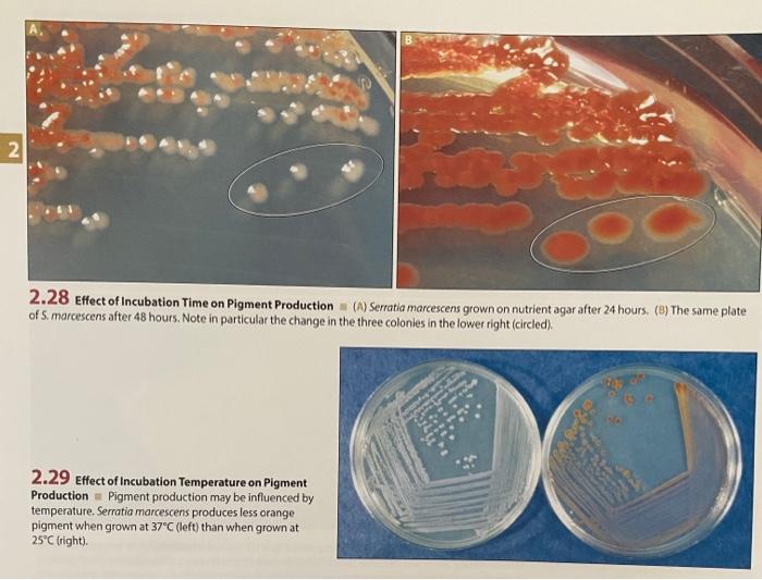 Serratia Marcescens Colony Morphology