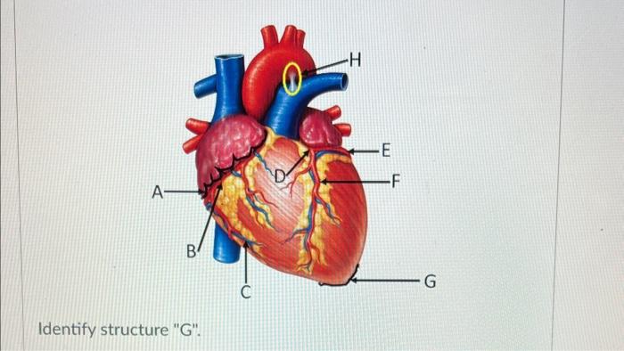 Solved Identify blood vessel "D". Identify structure | Chegg.com