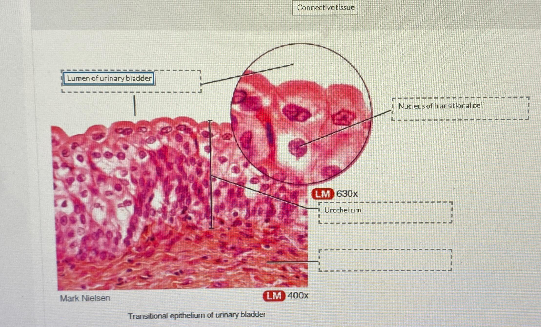 Solved ConnectivetissueTransitional epithelium of urinary | Chegg.com