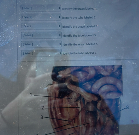 ﻿Identify the organ labeled 1. ﻿Identify the tube | Chegg.com