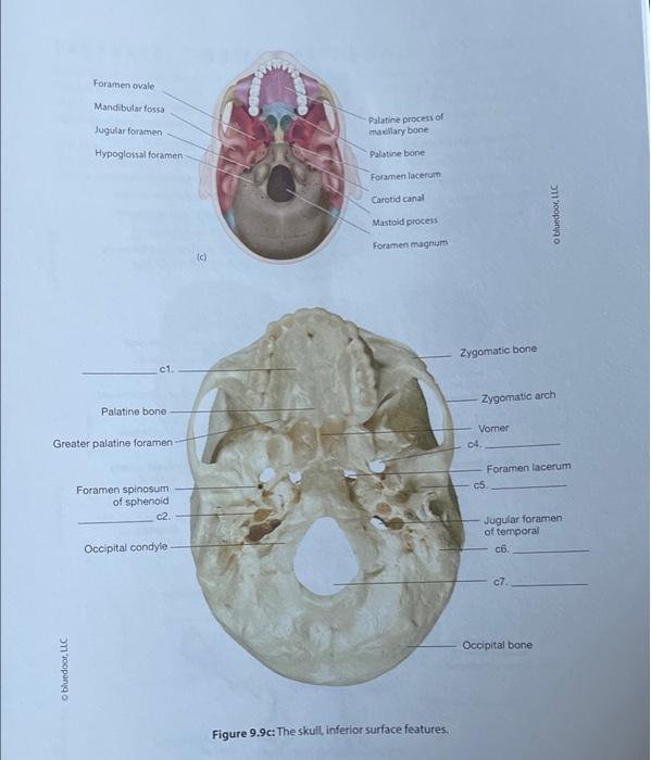 Solved Foramen ovale Mandibular fossa Jugular foramen | Chegg.com