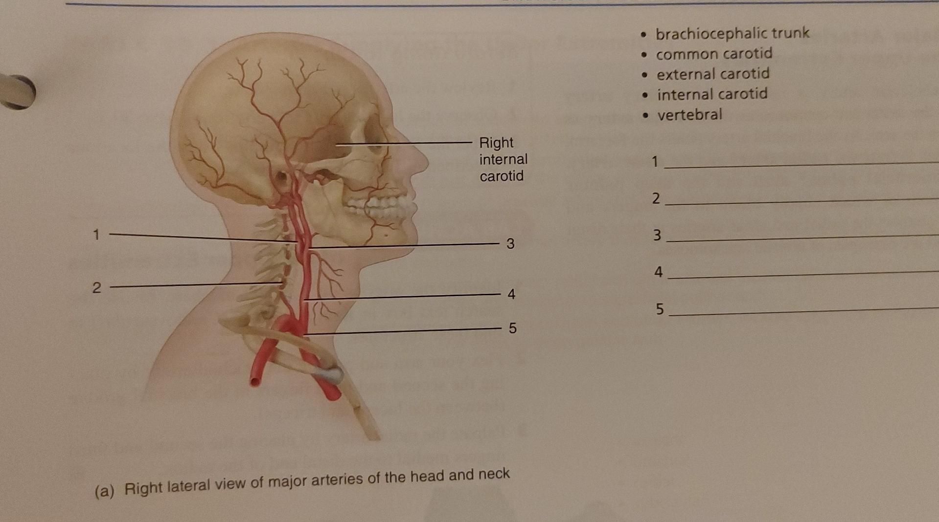 Solved - brachiocephalic trunk - common carotid - external | Chegg.com
