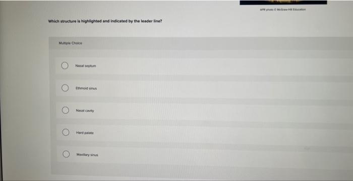 Solved 11 Which structure is highlighted and indicated by | Chegg.com