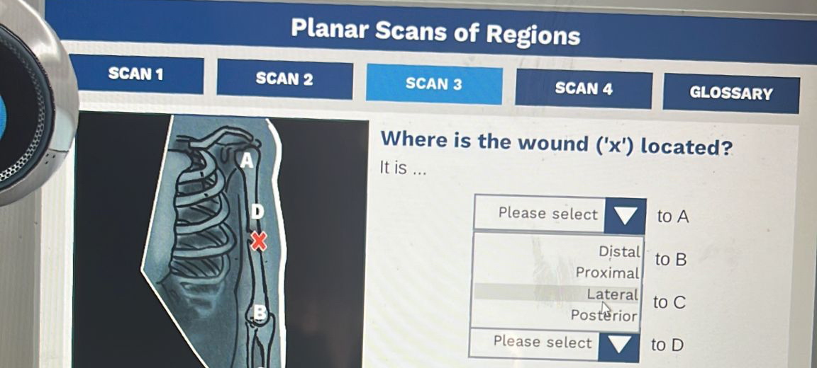 Solved Planar Scans of RegionsSCAN 1Where is the wound ('x') | Chegg.com