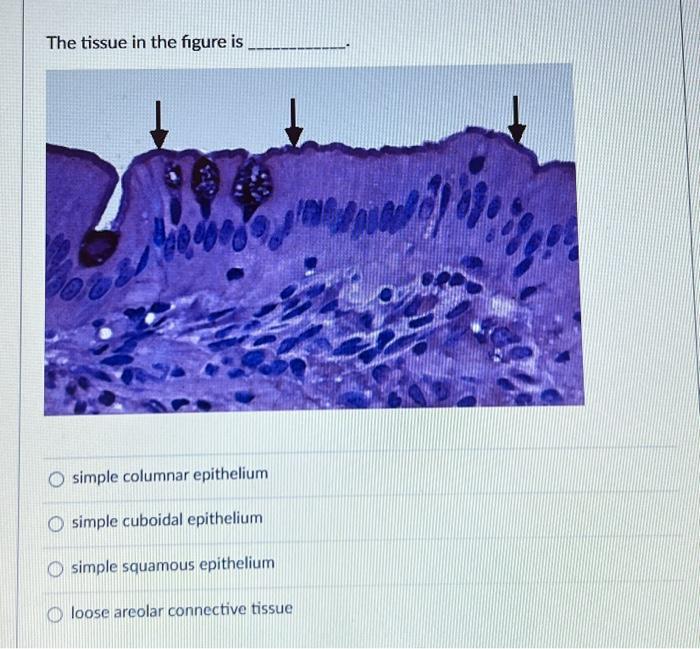 Solved The tissue in the figure is simple columnar | Chegg.com