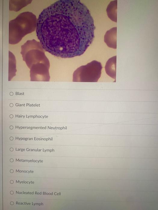 Solved O Blast Giant Platelet Hairy Lymphocyte | Chegg.com