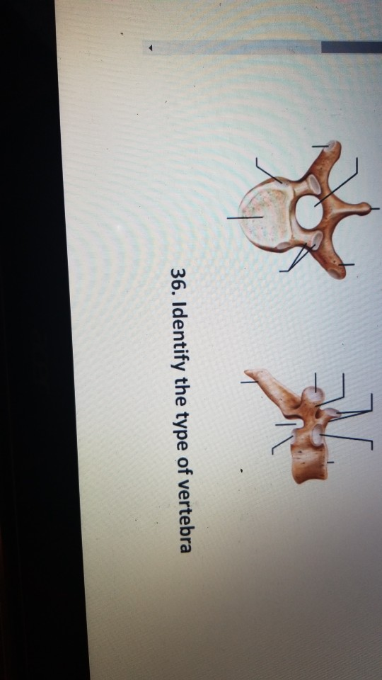 Solved QuCJIUN 2+1 pun) 32. Identify the structure pointed | Chegg.com