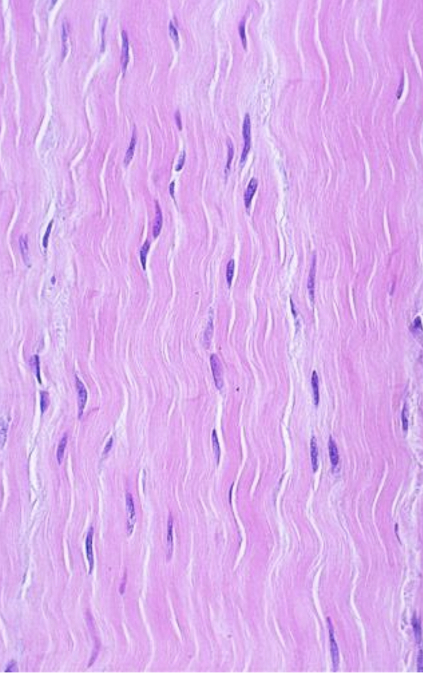 Solved What is this histology? Dense regular? Smooth muscle? | Chegg.com