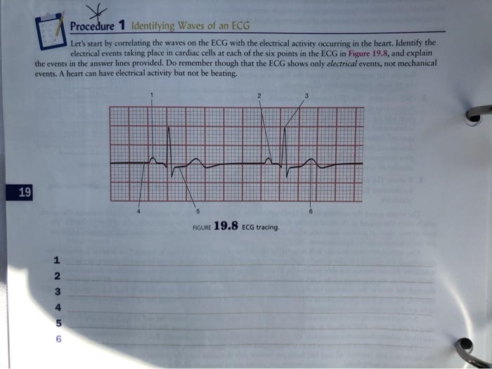 Solved Procedure 1 Identifying Waves of an ECG Let's start | Chegg.com