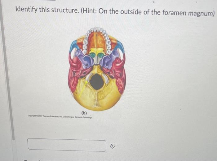 Solved Identify this structure. (Hint: On the outside of the | Chegg.com