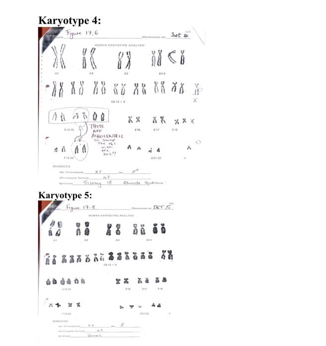 Solved Question 6 - Human Karyotype Analysis (10 marks) You | Chegg.com