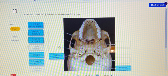 Solved Check my work . 11 Label the specific bony features | Chegg.com
