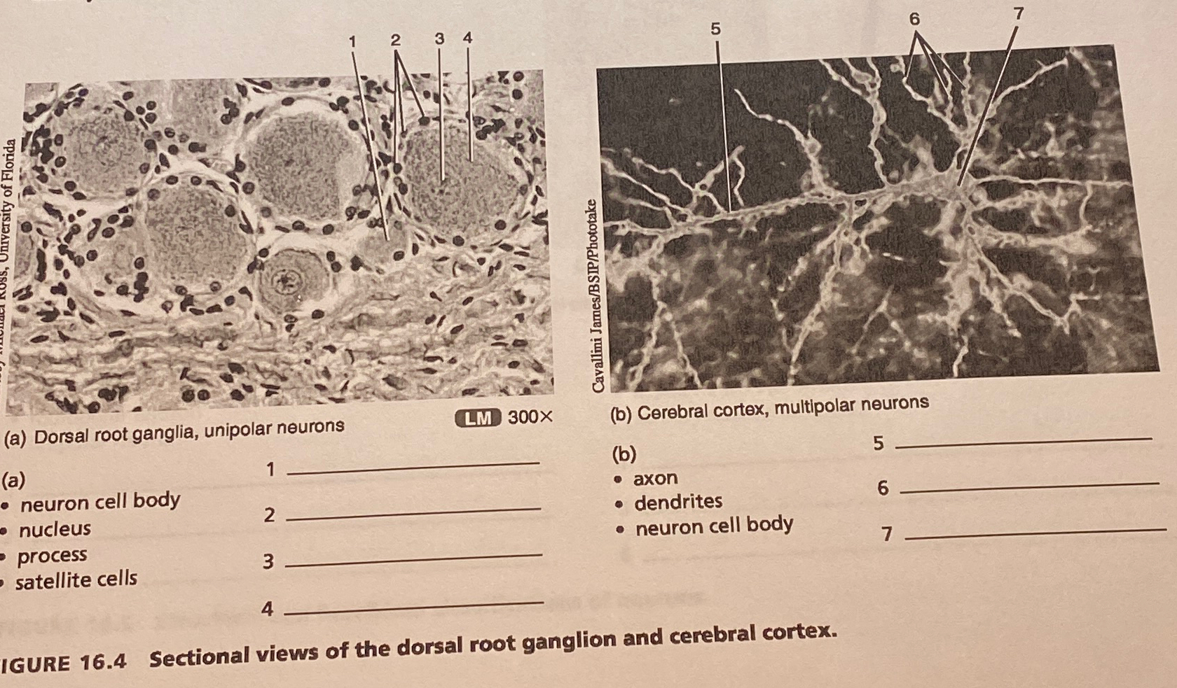Solved (a) ﻿Dorsal root ganglia, unipolar neurons(a)(b) | Chegg.com