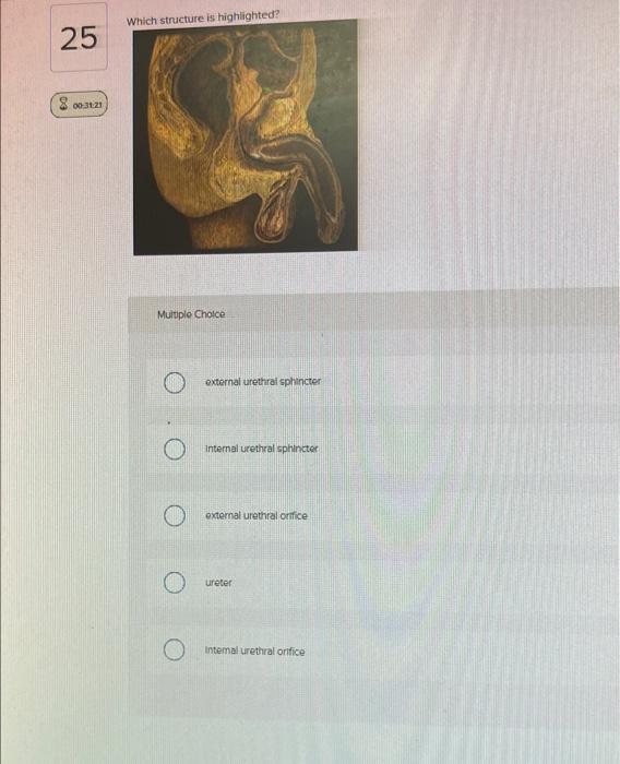 Solved Label the micrograph of the urinary bladder using the | Chegg.com