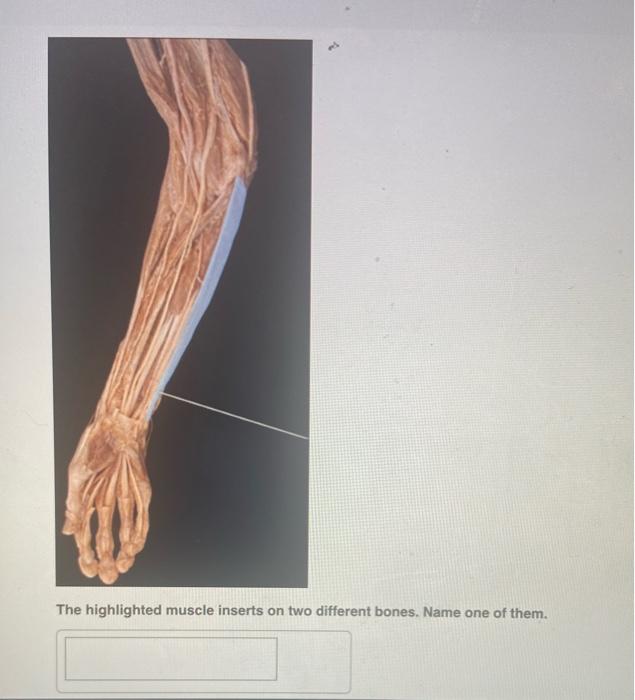 Solved Which structure is highlighted? anconeus muscle O | Chegg.com