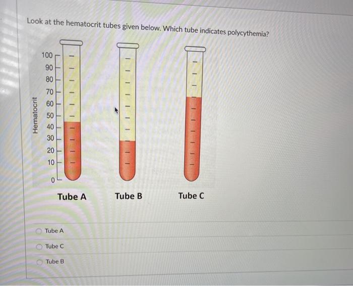 Solved Look at the hematocrit tubes given below. Which tube | Chegg.com