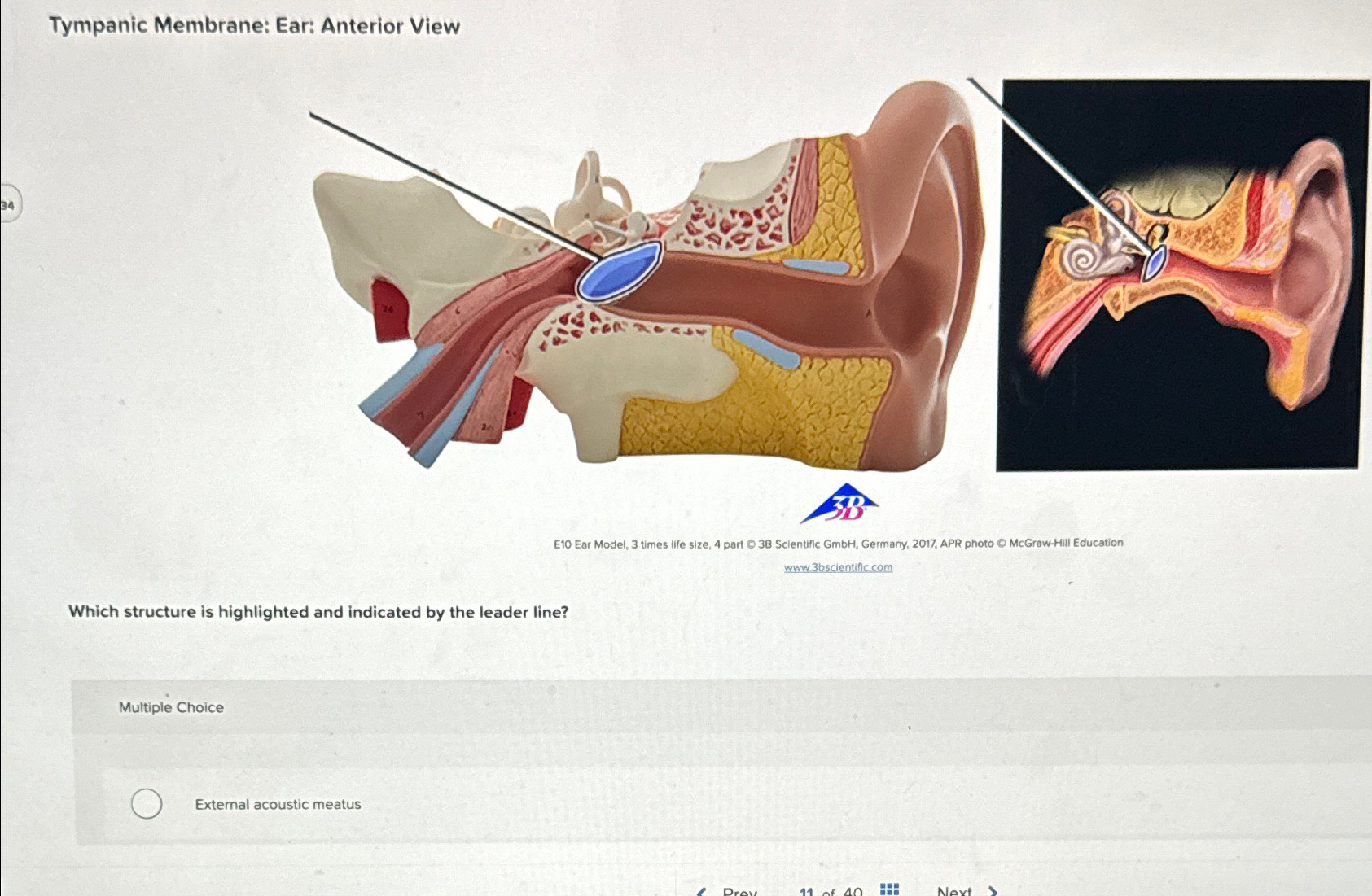 Solved Tympanic Membrane: Ear: Anterior View34E10 ﻿Ear | Chegg.com
