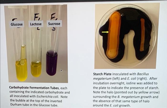 Name: Exercise 9 Results Starch Plate Observations | Chegg.com