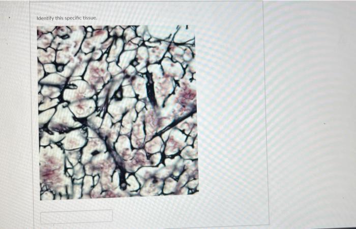 Solved Identify this specific tissue. | Chegg.com