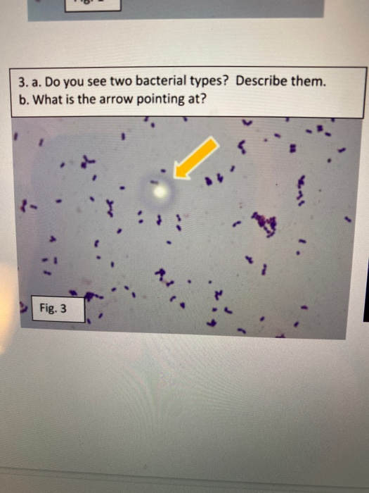 Solved 3a. Can you see two bacterial types? Describe their | Chegg.com