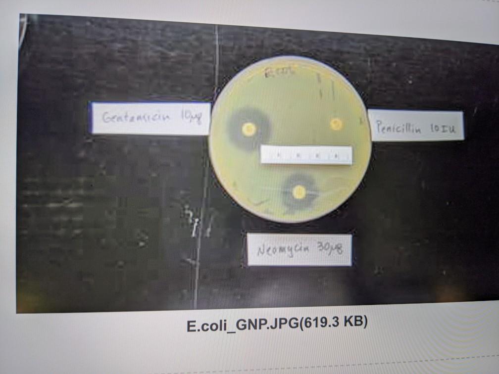 Disk Diffusion Results Diameter of Zone of Inhibition | Chegg.com