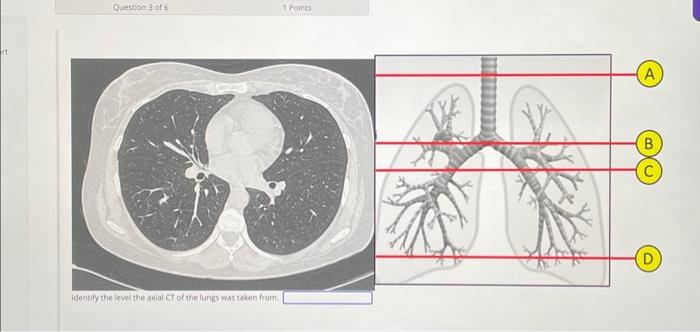 Solved what level is the CT taken from? A, B, C or D | Chegg.com