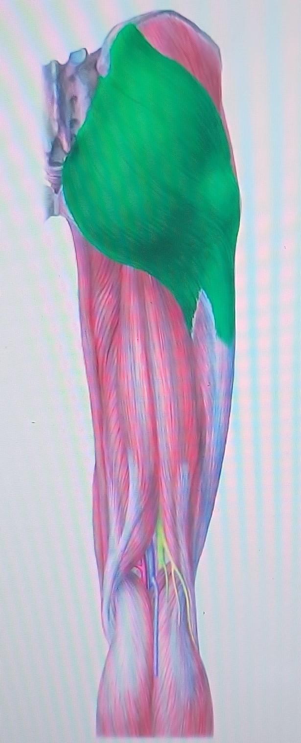 Solved name the muscle | Chegg.com